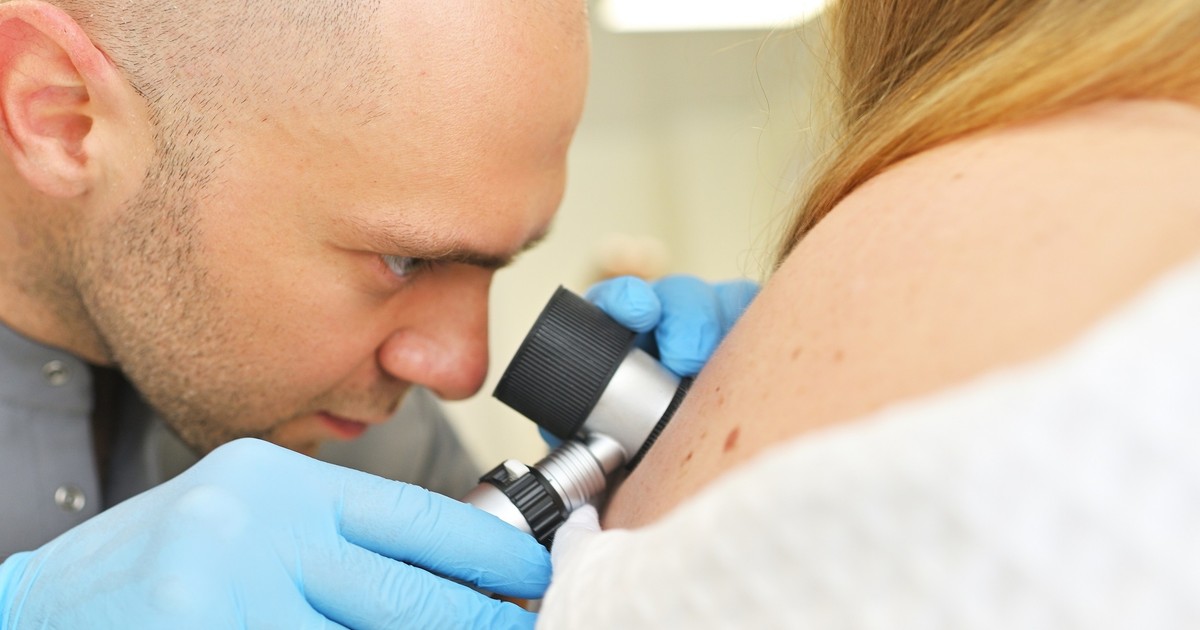 Basalioma, melanoma, spinalioma: ezek a 3 leggyakoribb bőrrák korai ...
